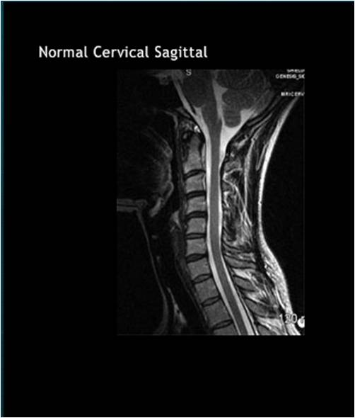 Shields MRI Blog | neck mri