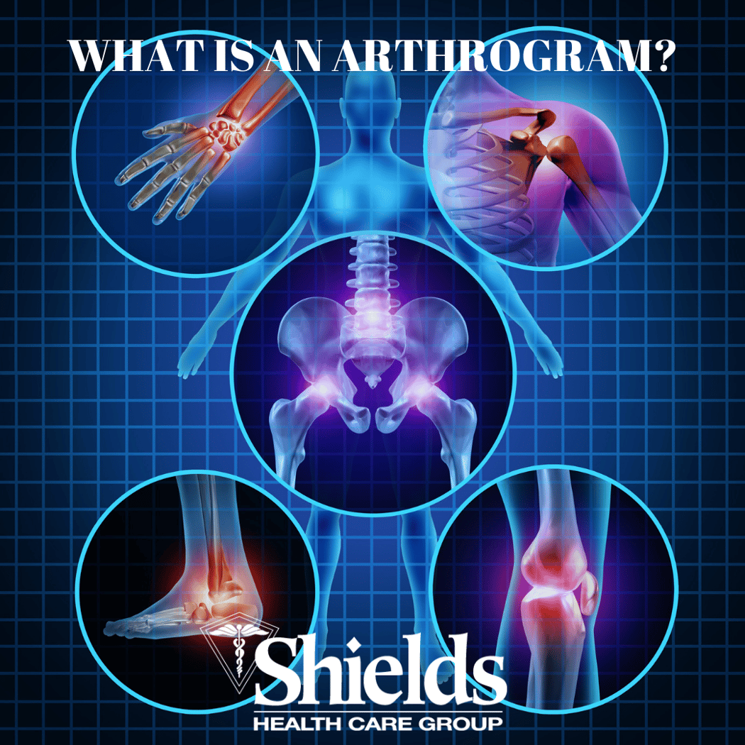 What is an arthrogram?